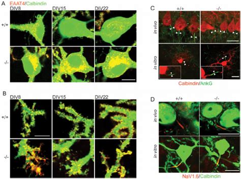 No Disruption To Ais Or Mislocalization Of Axonal Proteins In β Iii