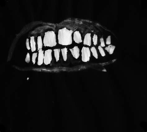 Bite On Imgur Bite On Imgur