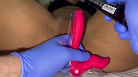 The Gynecologist Speculum Examination Brought Me To Orgasm Fluid Examination Free Sex Video