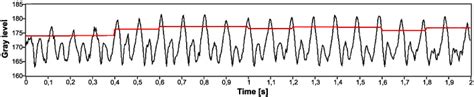 Adaptive Threshold Of Intensity Download Scientific Diagram