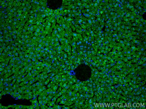 Fabp1 Antibody 68227 1 Ig Proteintech