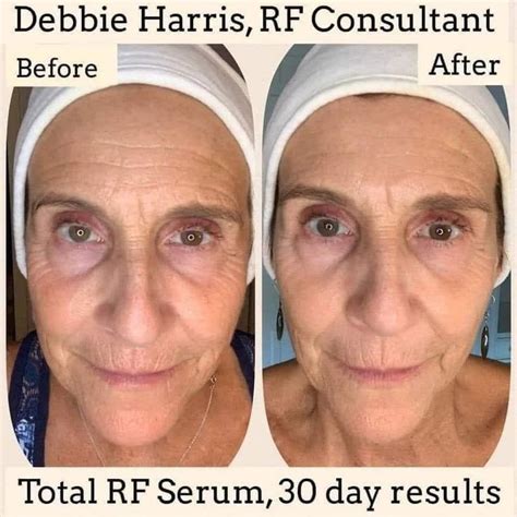 total rf serum reduce pores improve skin texture skin