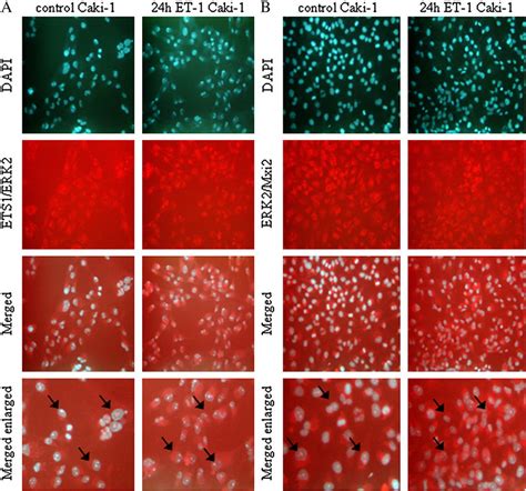 Duolink In Situ Proximity Ligation Assay 1 × 10 4 Caki 1 Cells Were