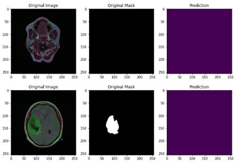 GitHub Piyush MRI Dataset Brain Disorders Detection Model