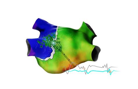The Top Cardiac Tech Stories Out Of Hrs 2026