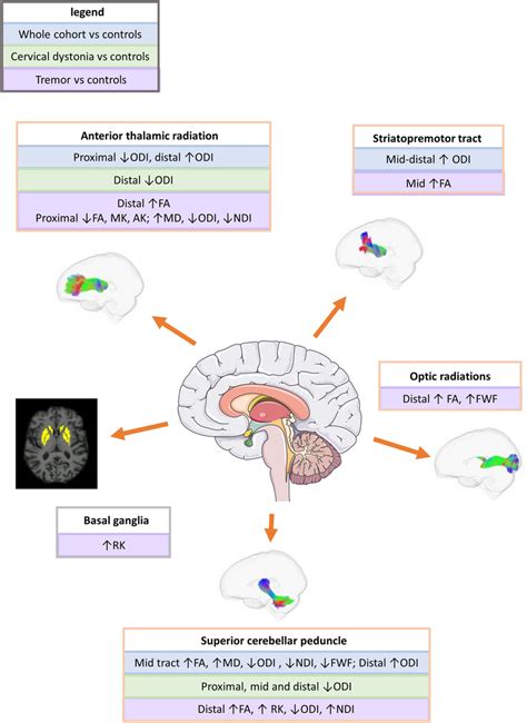 Of Key Findings FA Fractional Anisotropy MD Mean Diffusivity MK Mean Download Scientific