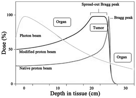 Photon Beam Radiation Therapy Clinical Trials The Best Picture Of Beam
