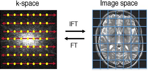 Figure 1 10 From 1 Principles Of Functional Magnetic Resonance Imaging Semantic Scholar