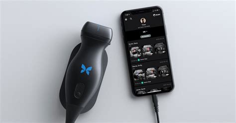 Butterfly Iq Now Approved By Health Canada