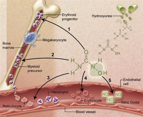 Hydroxyurea For Sickle Cell Anemia What Have We Learned And What