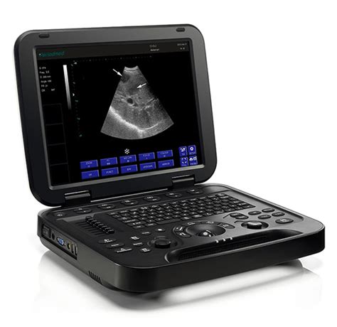 Digital Diagnostic Ultrasound System Pu Dl151a China Digital