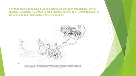Abdominal Hysterectomy Pptx