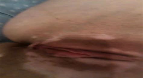 Vitiligo Ex Girlfriend Body Show Eporner