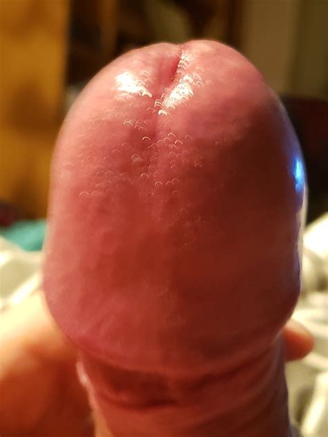 Monster Mushroom Cock Head Pics Xhamster