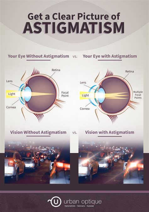 Does Astigmatism Affect Glasses At Connor Alexander Blog