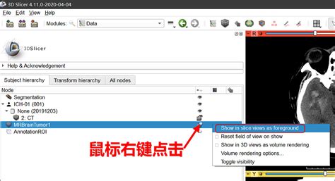 在data模块中如何将序列重叠观看？ 问题求助 3dslicer中文论坛