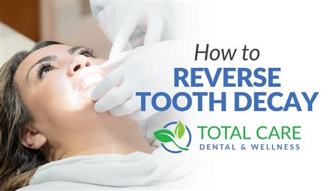 How To Reverse Tooth Decay Total Care Dental Holistic Dentistry