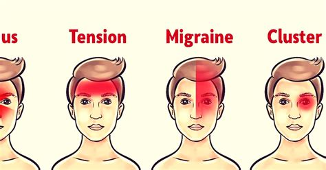Most Usual Types Of Headaches What They Indicate About Your Health And The Best NATURAL