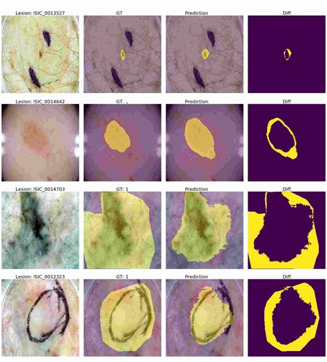 Skin Lesion Segmentation Using U Net And Good Training Strategies Deepai