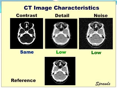 Ct Ct Image Quality Quality Control Spatial Resolution