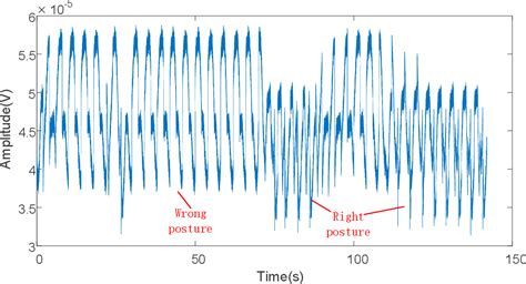 Figure 1 From Non Contact Driver Respiration Rate Detection Technology Based On Suppression Of
