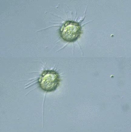 Protist Images Difflugia Globulosa Protist Images Difflugia Globulosa