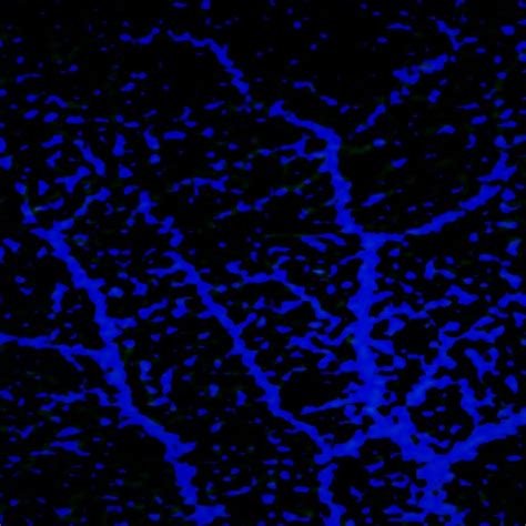 Retinal Oct And Octa Data Preprocessed Kaggle
