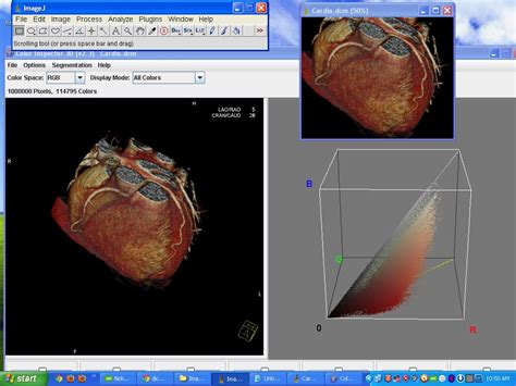programming tips dicom image viewer in imagej tool imagej dicom viewer