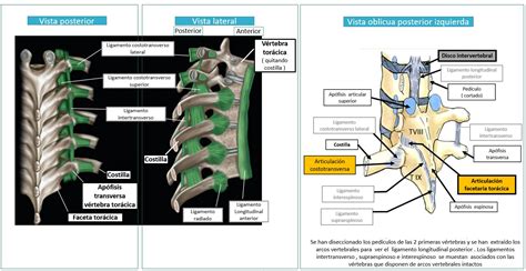 Anatomía Del Espacio Paravertebral Torácico Dolopedia