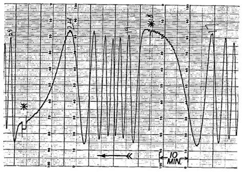 A Section Of The Fringe Count Recorder Chart Fractional Fringes Are