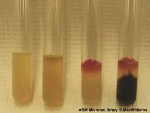 Sulfide Indole Motility SIM Medium Principle Procedure And Results Microbe Online