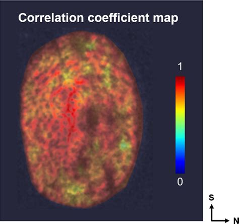 An Example Of Correlation Coefficient Map Overlaid On The Oct Image M2