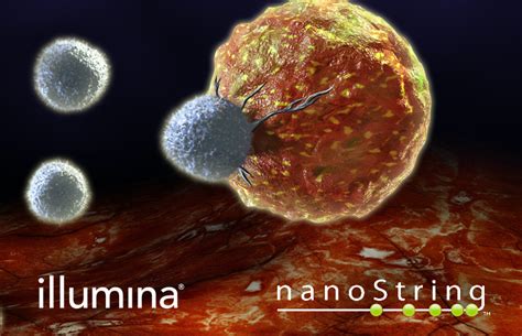 Spatial Landscape Of The Immune Microenvironment In Metastatic Prostate Cancer Using GeoMx