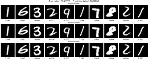 Multi Scale Attention Based Multiple Instance Learning For