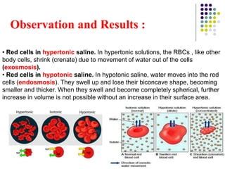 Osmotic Fragility Test Pathology Ppt