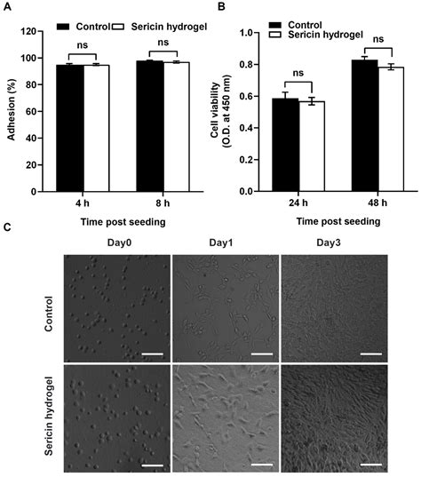 A Sterile Injectable And Robust Sericin Hydrogel Prepared By Degraded