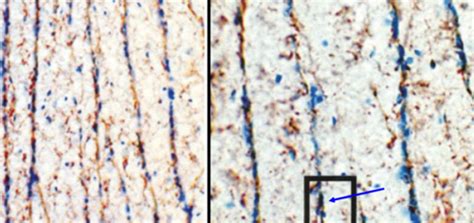 Lecture 3 Cns And Neuronal Development Flashcards Quizlet