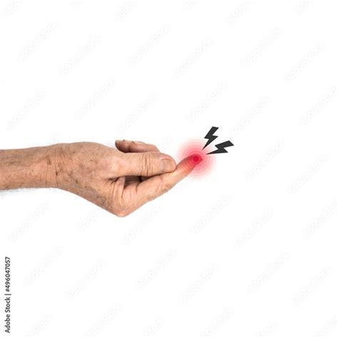 Cellulitis Finger Tip