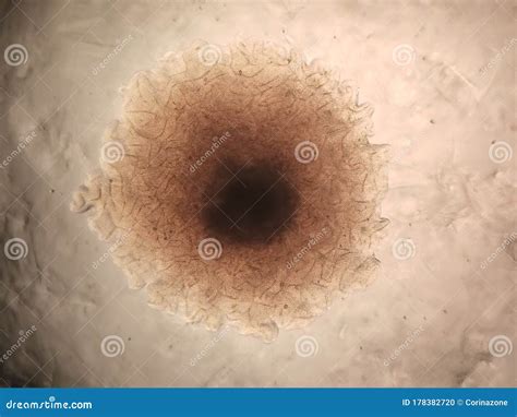 Bacillus Subtilis And Aspergillus Niger Growing On Nutrient Agar Medium