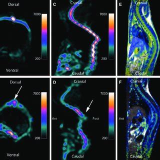 Visual Comparison Of Diffusion Tensor Imaging DTI Download Scientific Diagram