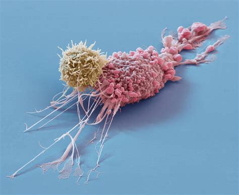 Cancer Cells Under Electron Microscope