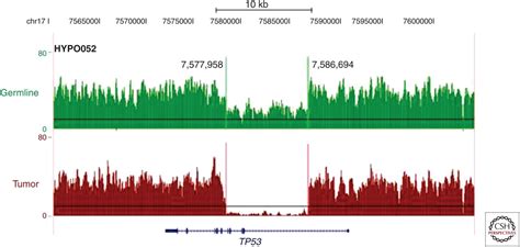 Tp53 Mutations In Hypodiploid Acute Lymphoblastic Leukemia