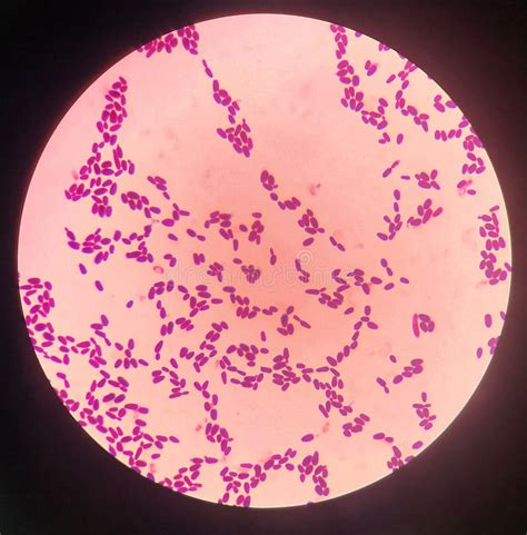 Yeast Cells Under A Microscope