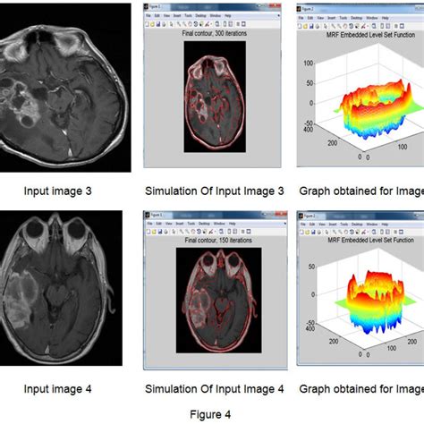 image segmentation using mrf novel level set method biosciences biotechnology research asia