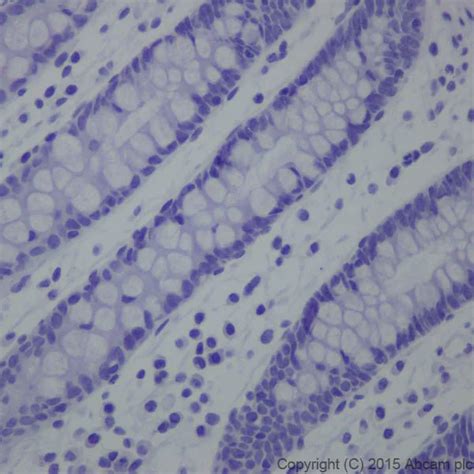 Phospholipase C Beta 1 Plcb1抗体[epr19085] Ab182359 Abcam中文官网