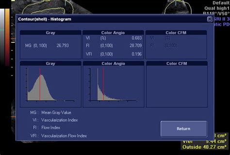 Virtual Organ Computer Aided Analysis Vocal Measuring Endometrial