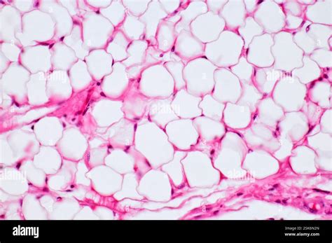 Fat Tissue Light Micrograph Adipocytes Fat Cells Store Energy As An Insulating Layer Of Fat