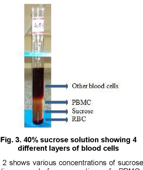 Figure 2 From Separation And Optimisation Of A Sucrose Density Gradient