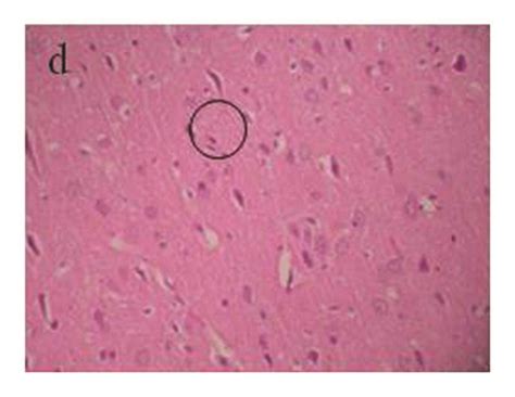 Microstructure Of Brain Tissue Under Light Microscope With 200 × Download Scientific Diagram