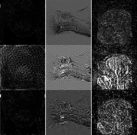 Figure 1 From Real Time Dynamic Mri Reconstruction Using Stacked Denoising Autoencoder